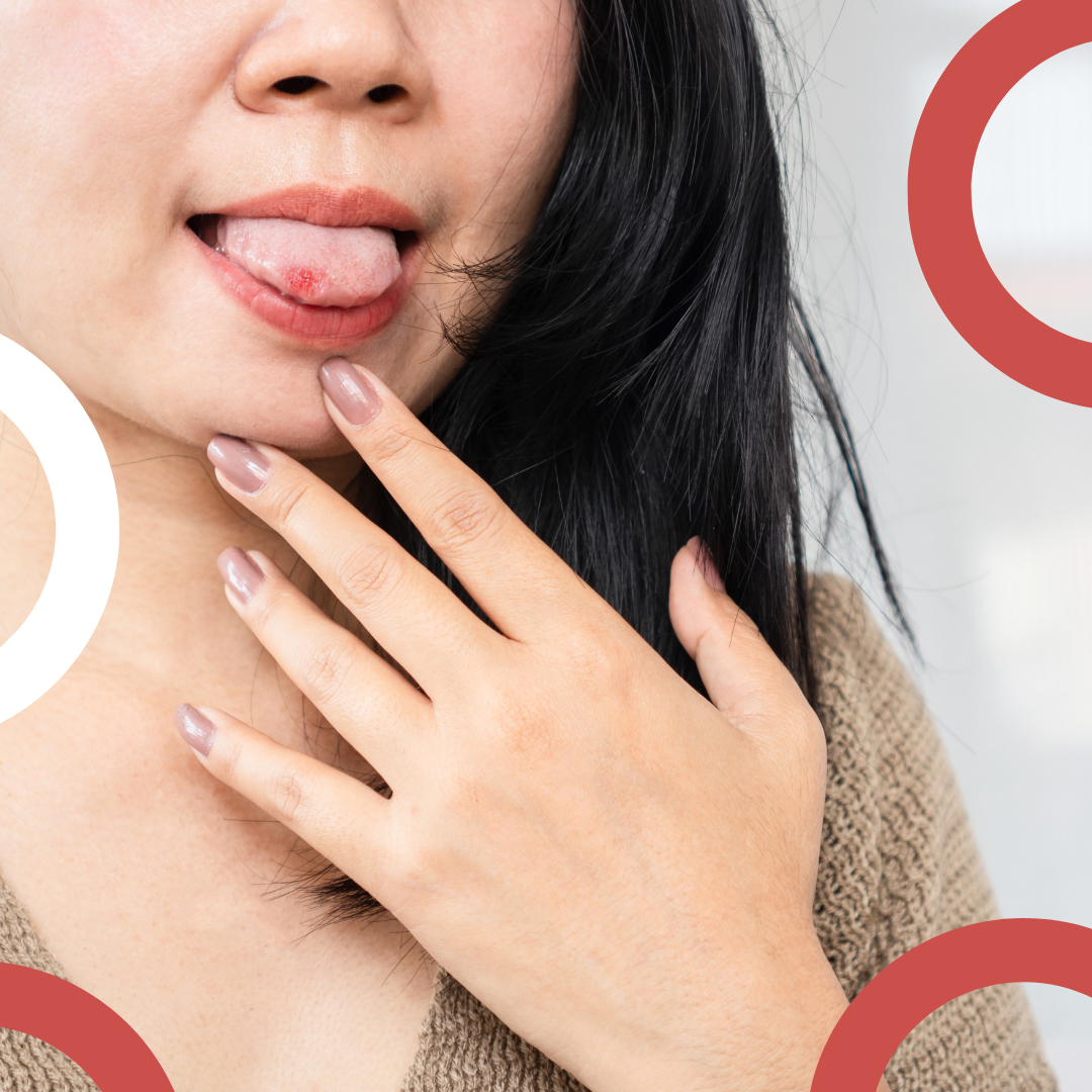 What You Need to Know About Burning Mouth Syndrome - Water Town Dental ...