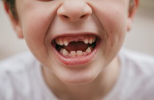 Baby Teeth Eruption and Care - Charts, Timelines, and Expert Tips for ...